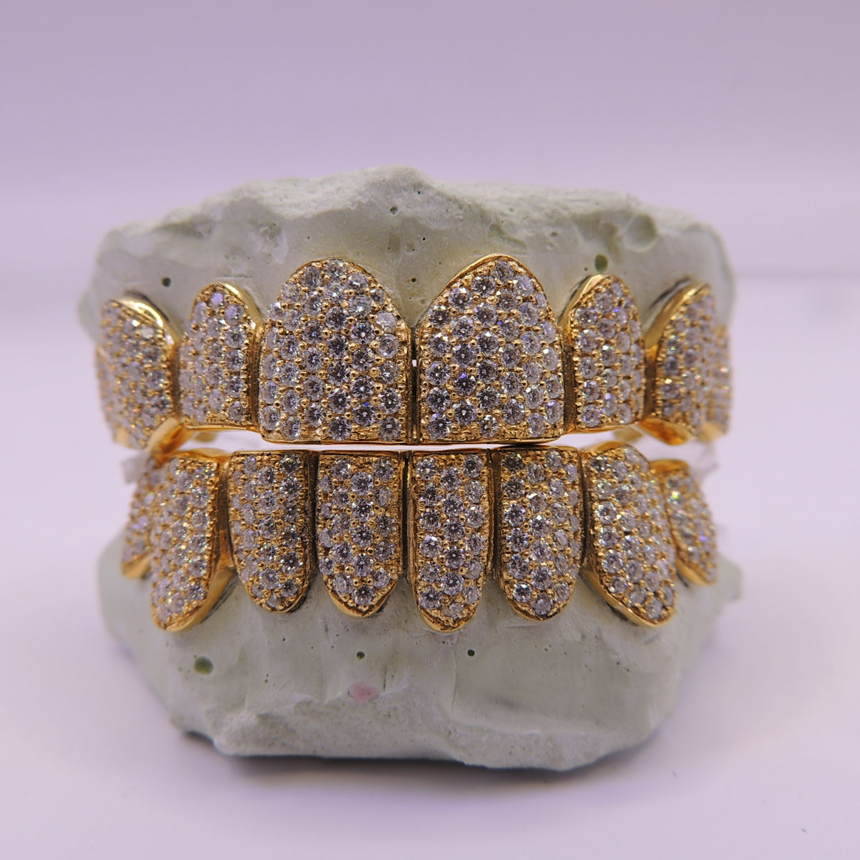 Diamond Grill – D-Town Customs